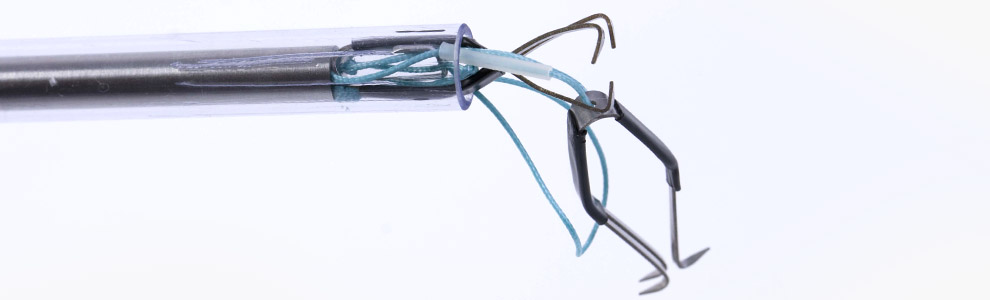 Surgical Perspective, Tpea Lifter, Versa Lifter, Versa Lifter Band ...